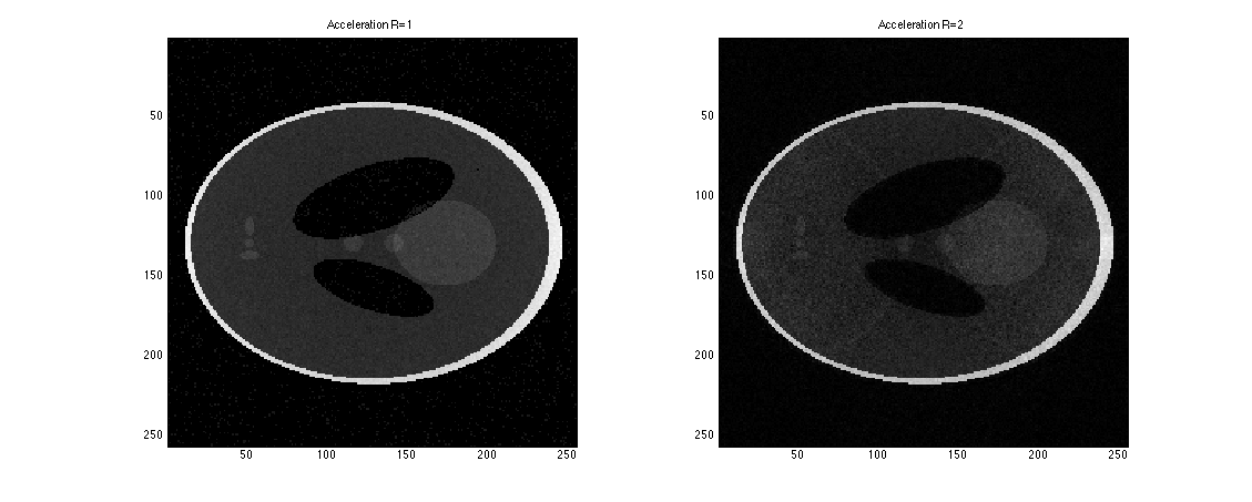 Cartesian 2D Parallel MRI (GRAPPA) - jackyko1991/gadgetron GitHub Wiki